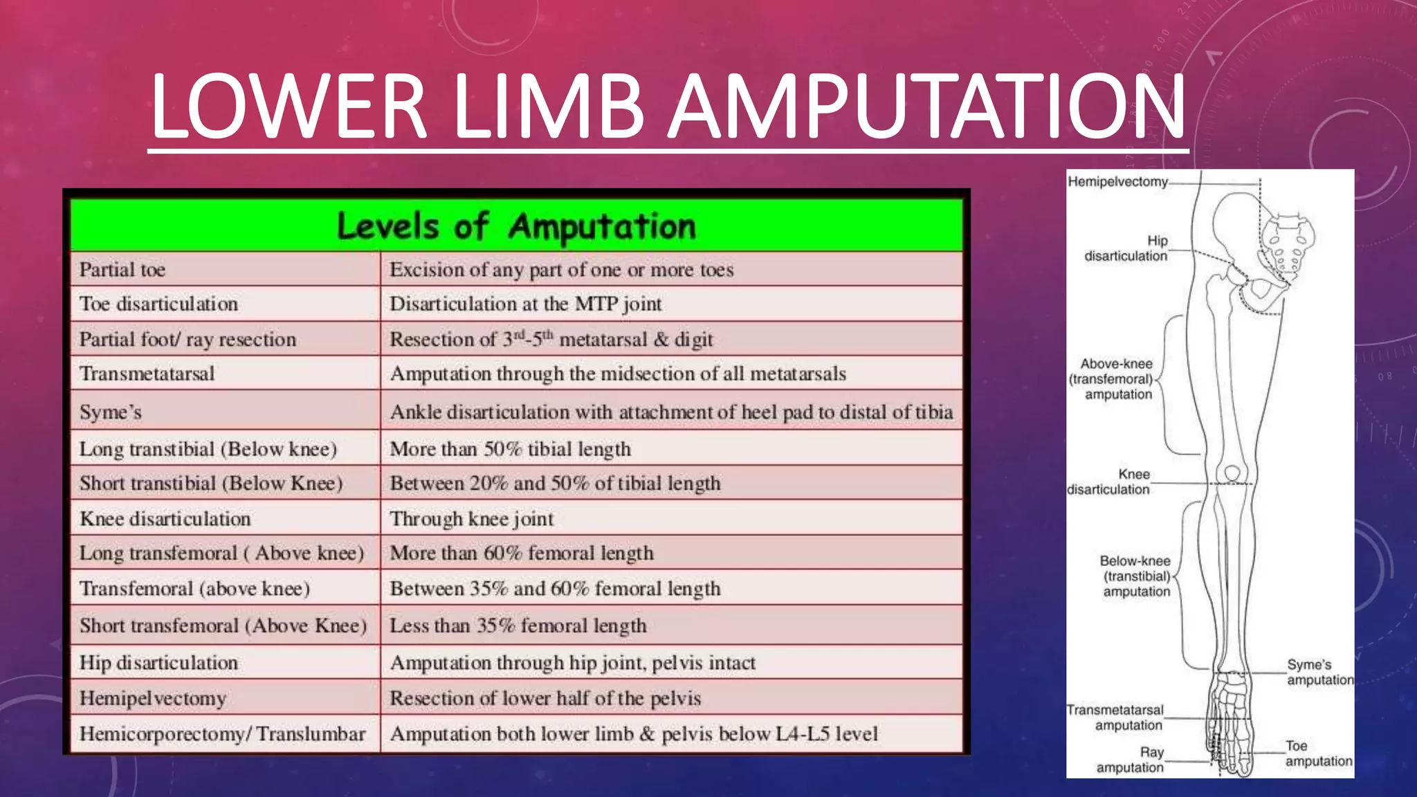 Prosthetic management of different levels of amputation | PPTX