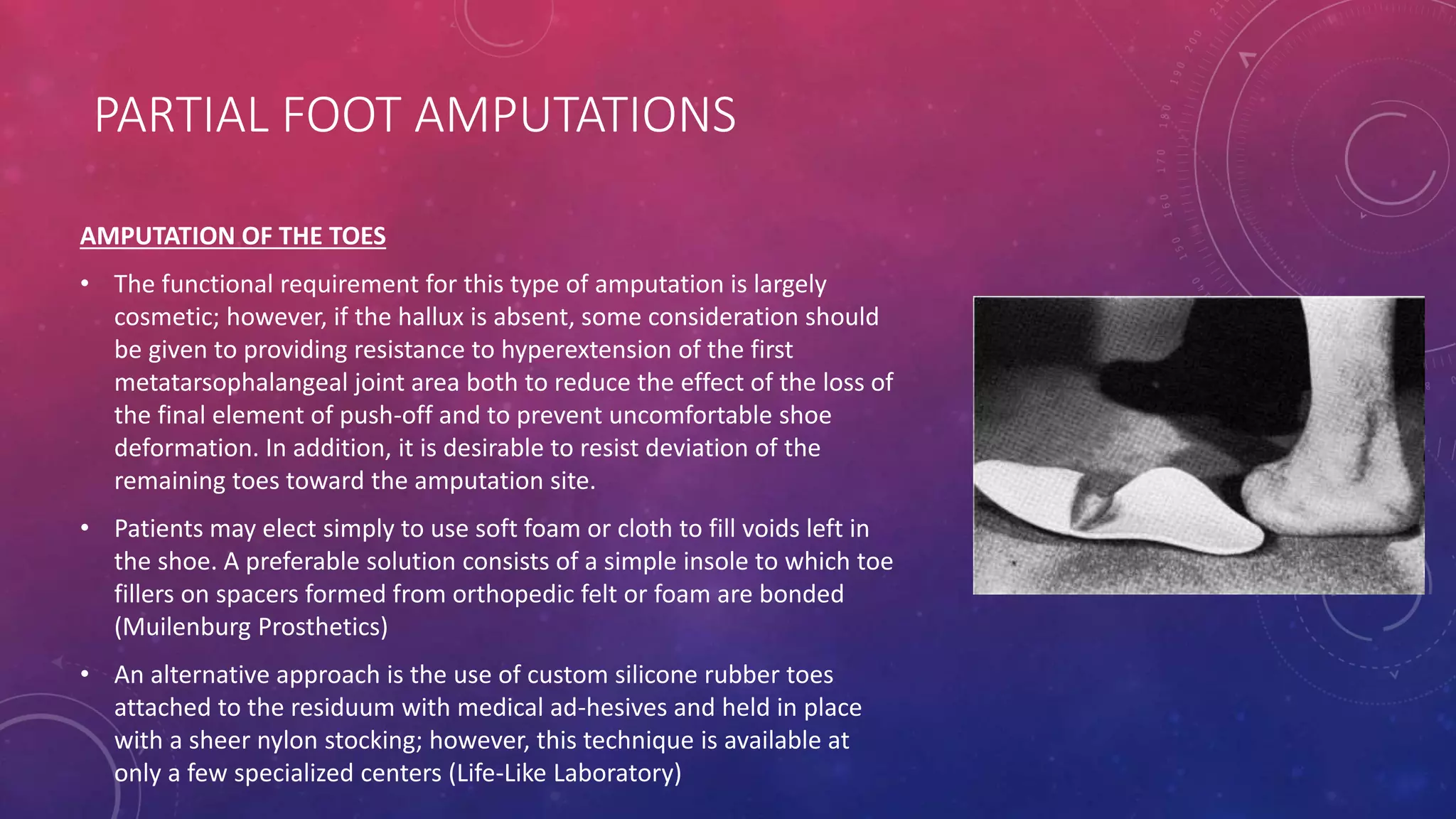 Prosthetic management of different levels of amputation | PPTX