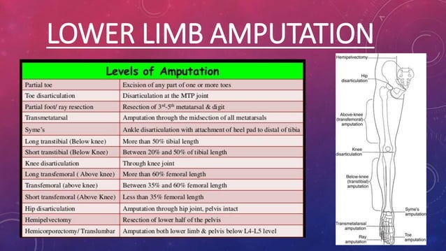 Prosthetic management of different levels of amputation | PPTX