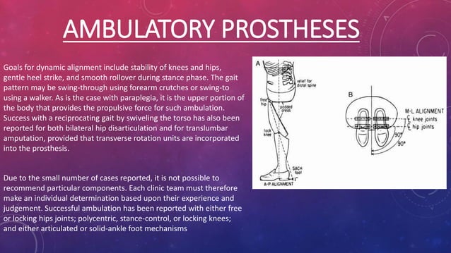 Prosthetic management of different levels of amputation | PPTX