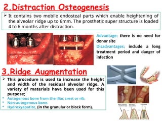 Prosthetic Management of Flat Ridge..ppt