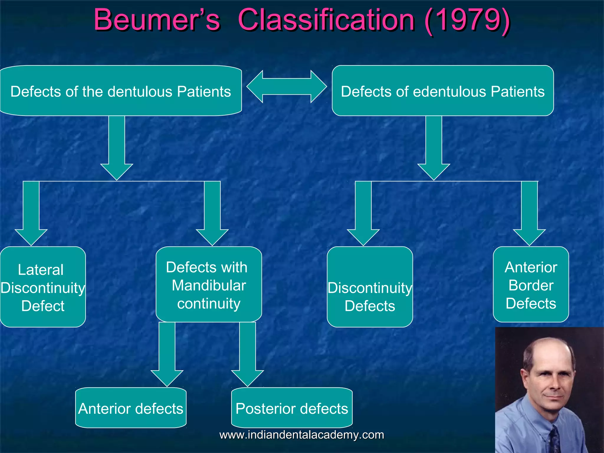 Prosthetic management of mandibulectomy and glossectomy pati ...
