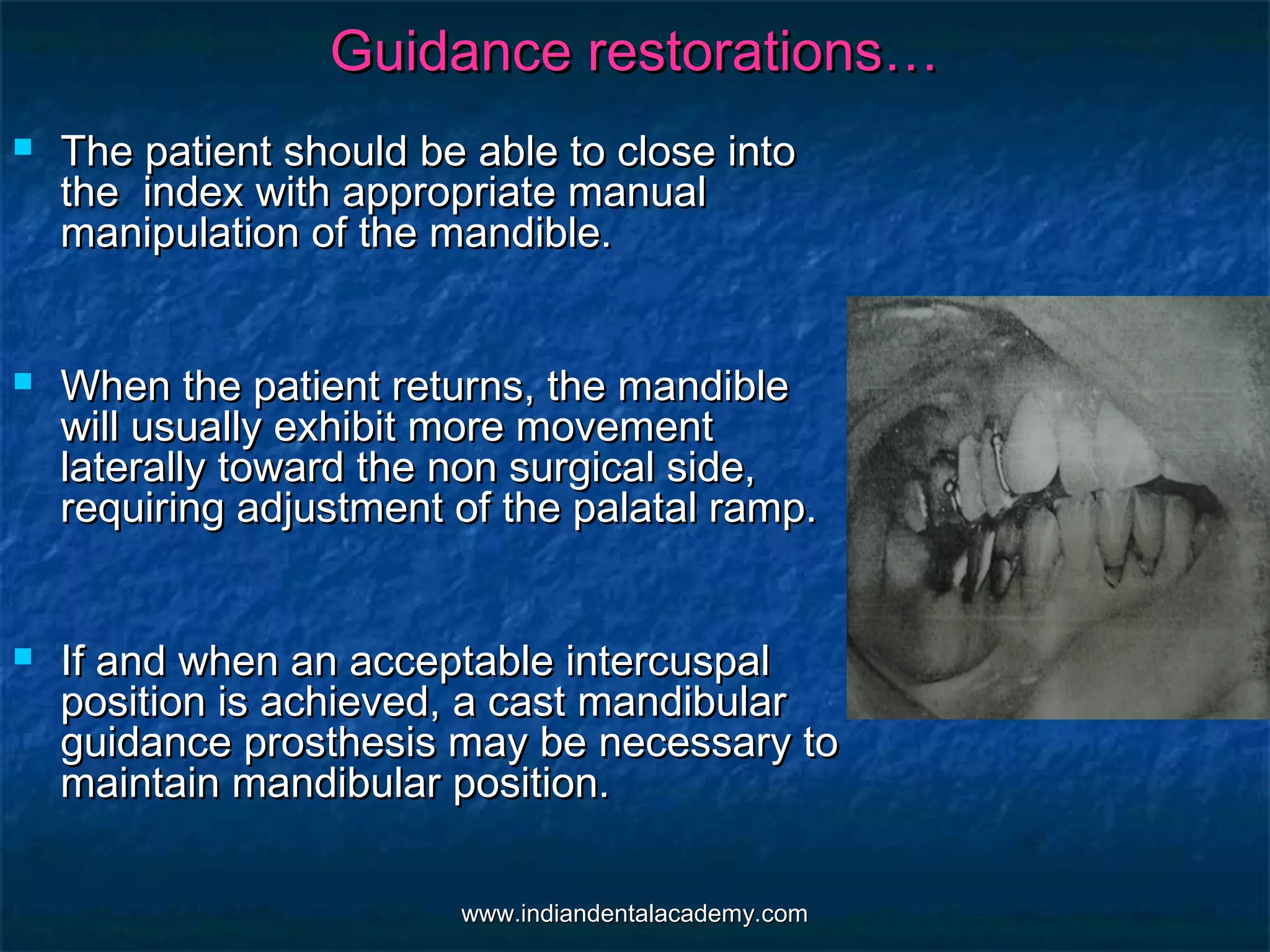 Prosthetic management of mandibulectomy and glossectomy pati ...