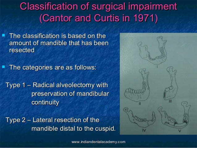 Prosthetic management of mandibulectomy and glossectomy pati/ orthodo…