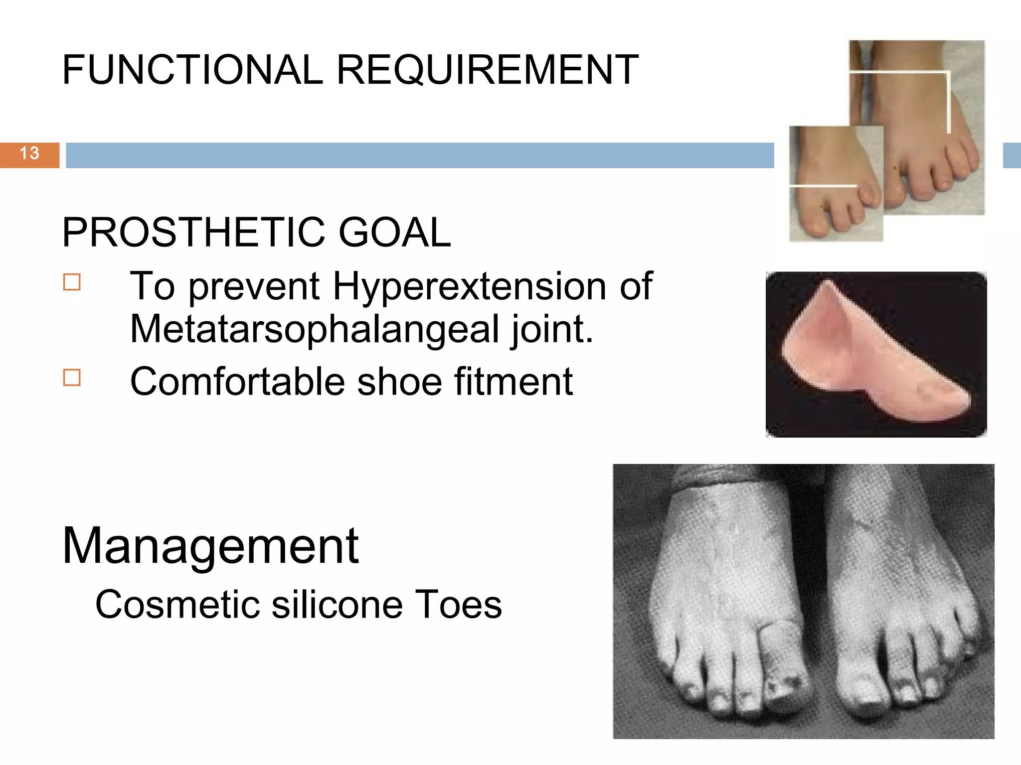 Prosthetic management of symes and partial foot amputation | PPT