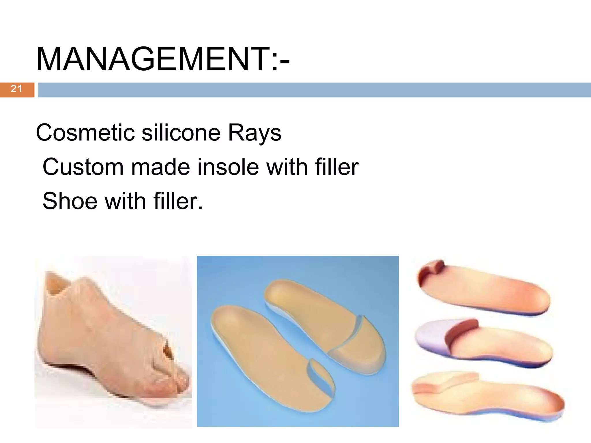 Prosthetic management of symes and partial foot amputation | PPT