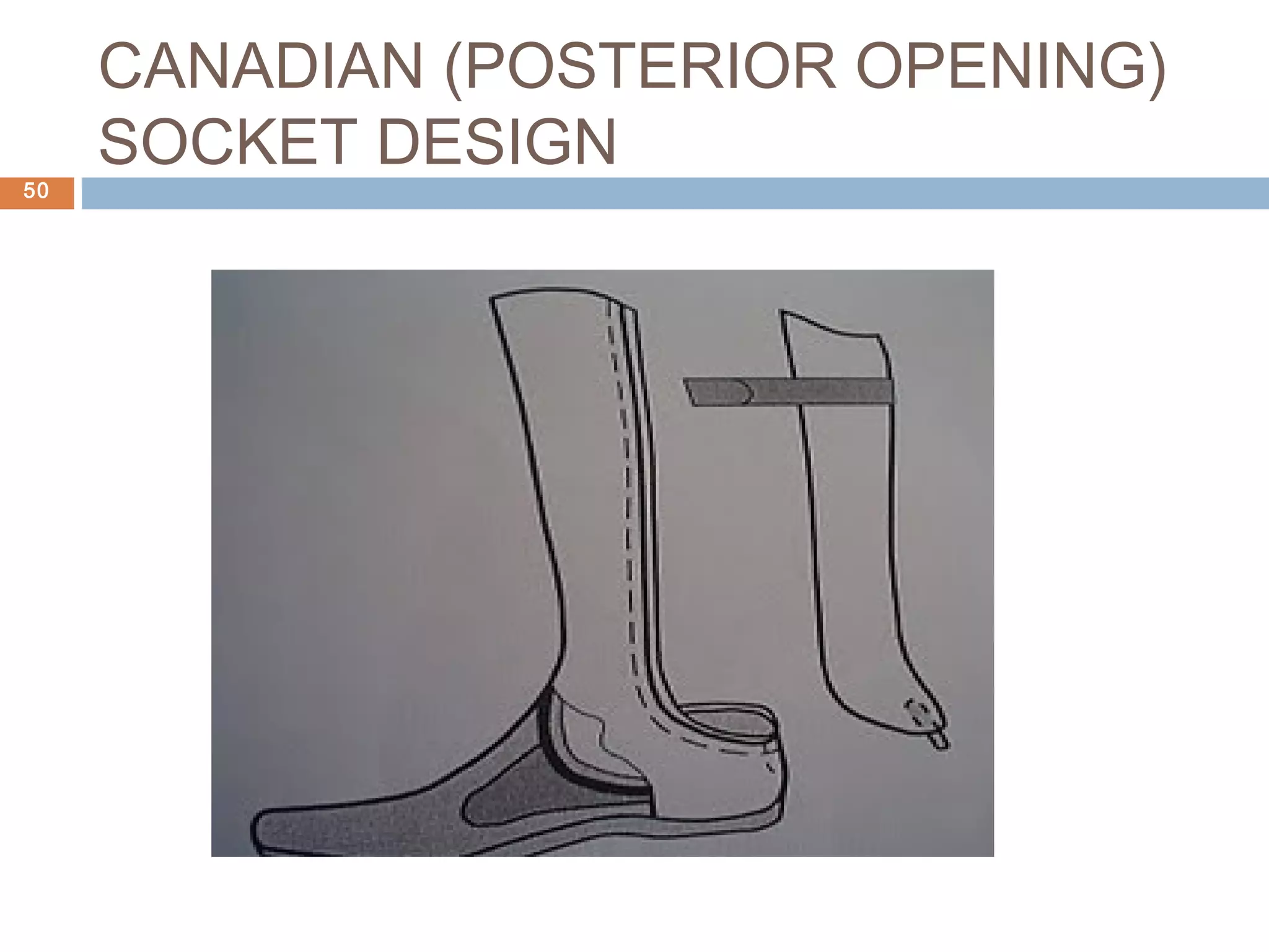 Prosthetic management of symes and partial foot amputation | PPT