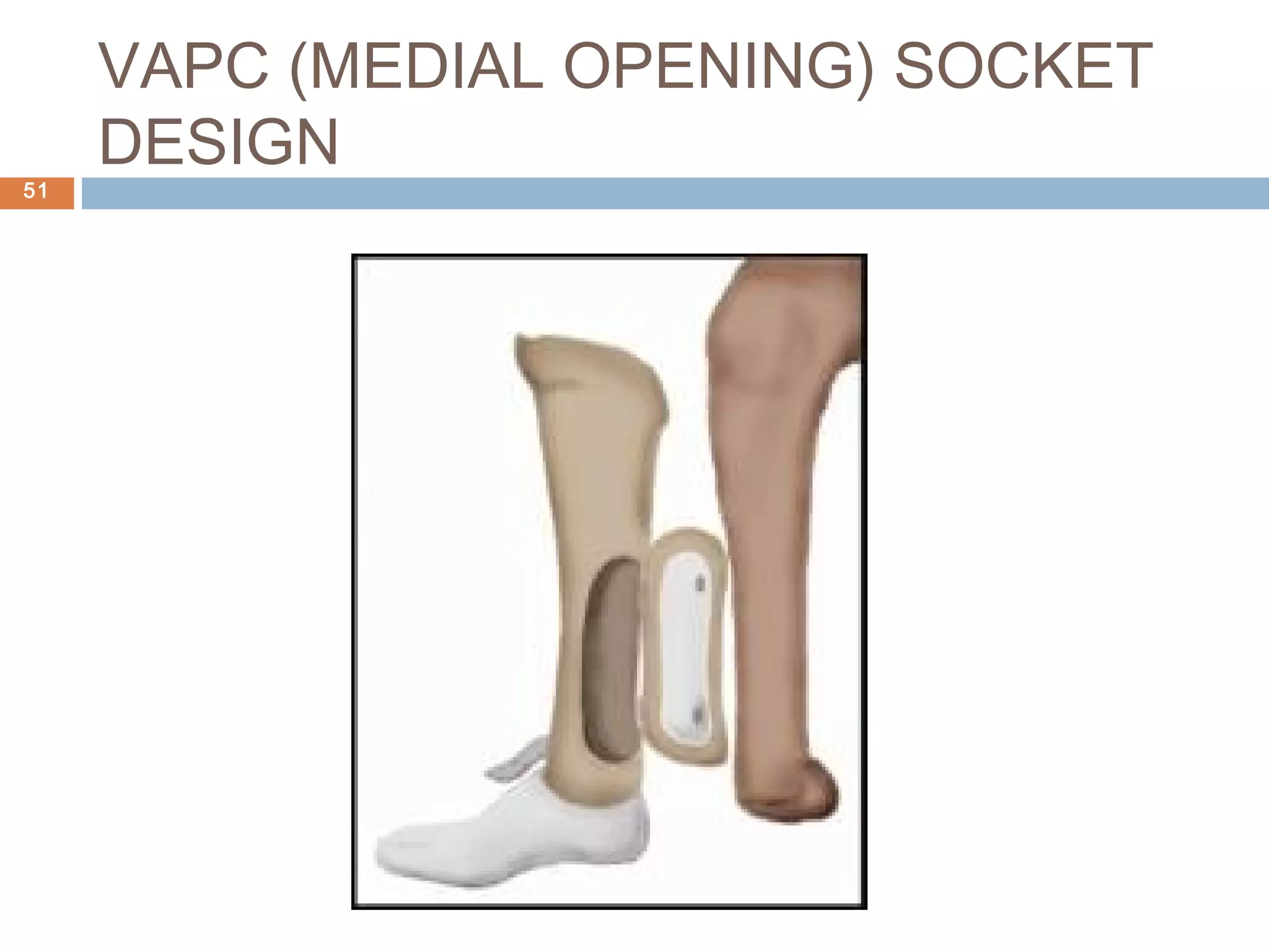 Prosthetic management of symes and partial foot amputation | PPT