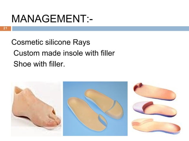 Prosthetic management of symes and partial foot amputation | PPT