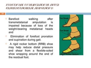 Prosthetic management of symes and partial foot amputation | PPT