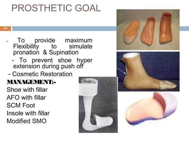 Prosthetic management of symes and partial foot amputation | PPT