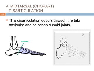 Prosthetic management of symes and partial foot amputation | PPT