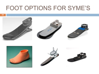 Prosthetic management of symes and partial foot amputation | PPT