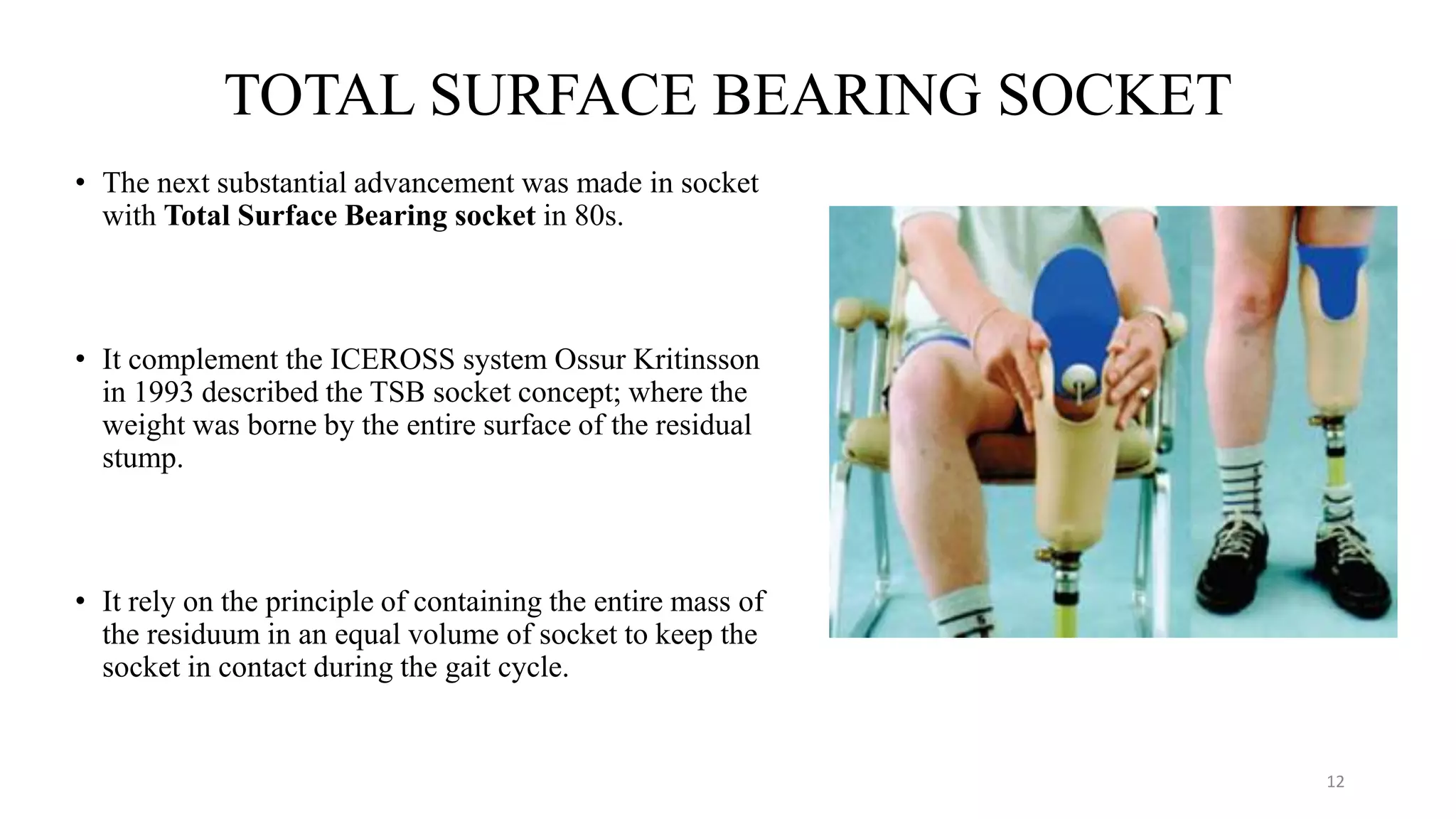 PROSTHETIC MANAGEMENT OF TRANSTIBIAL AMPUTATION AND ITS BIOMECHANICS | PDF