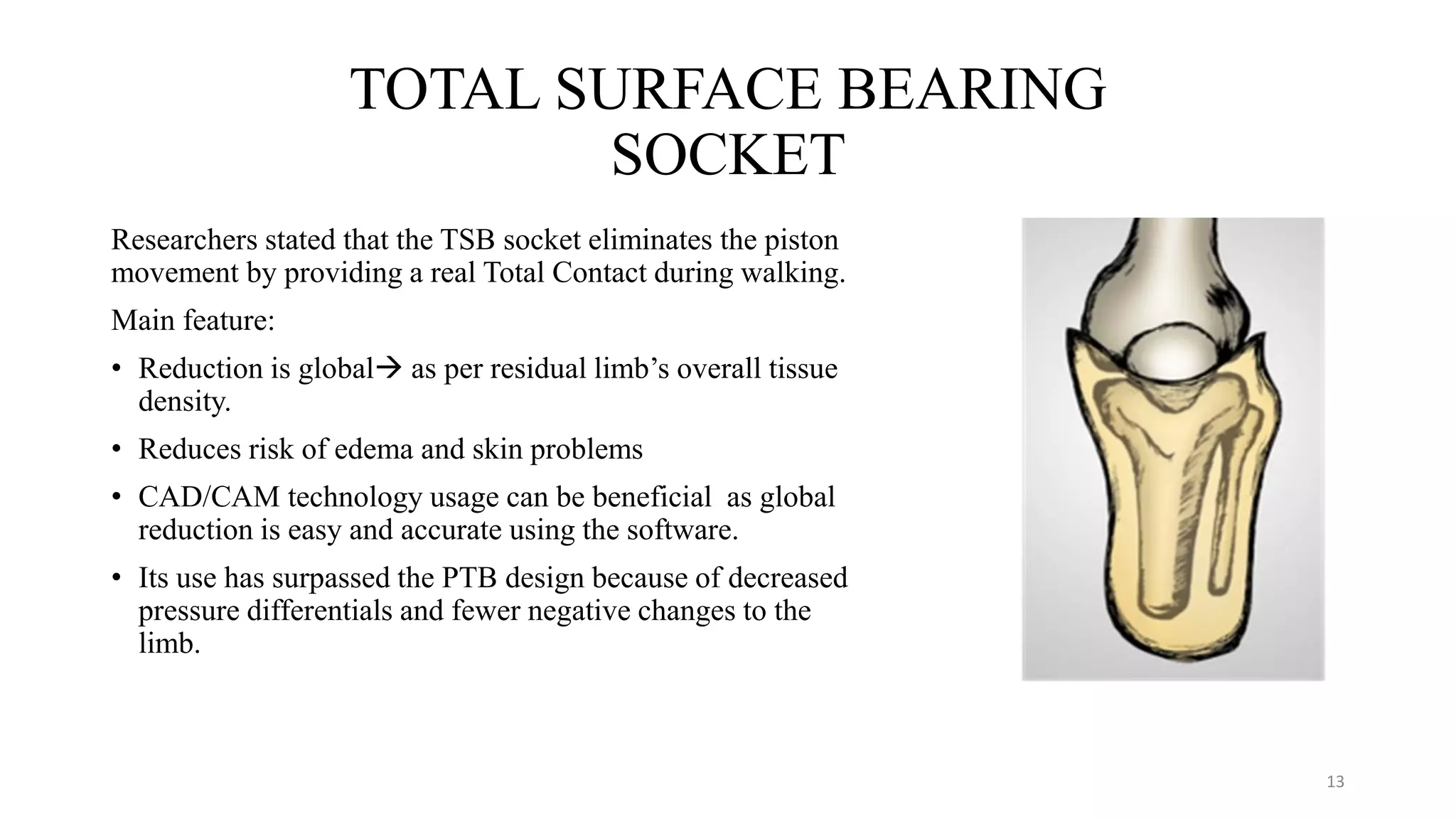 PROSTHETIC MANAGEMENT OF TRANSTIBIAL AMPUTATION AND ITS BIOMECHANICS | PDF
