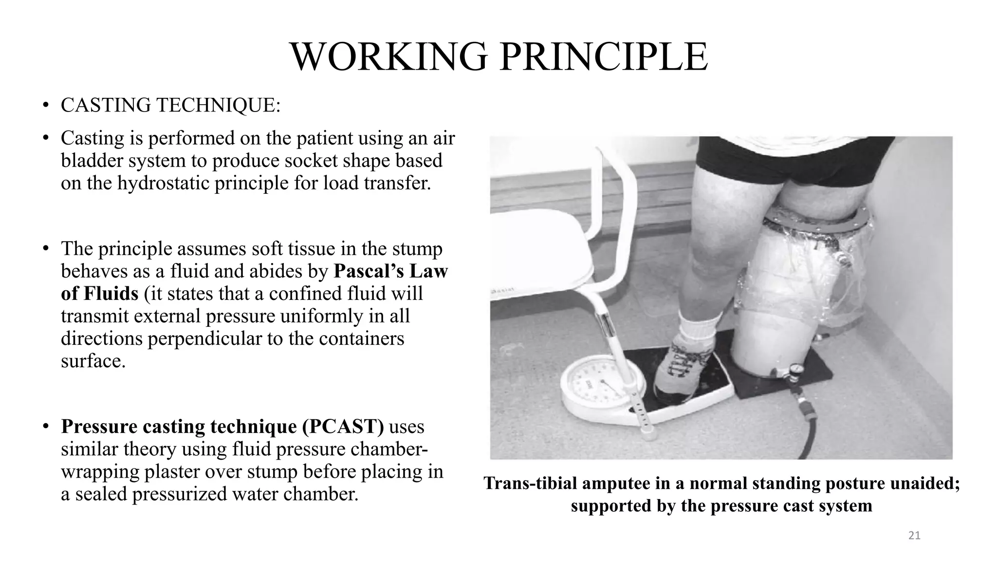 PROSTHETIC MANAGEMENT OF TRANSTIBIAL AMPUTATION AND ITS BIOMECHANICS | PDF
