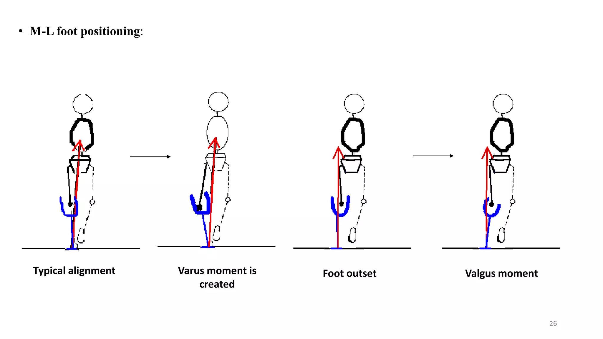 PROSTHETIC MANAGEMENT OF TRANSTIBIAL AMPUTATION AND ITS BIOMECHANICS | PDF