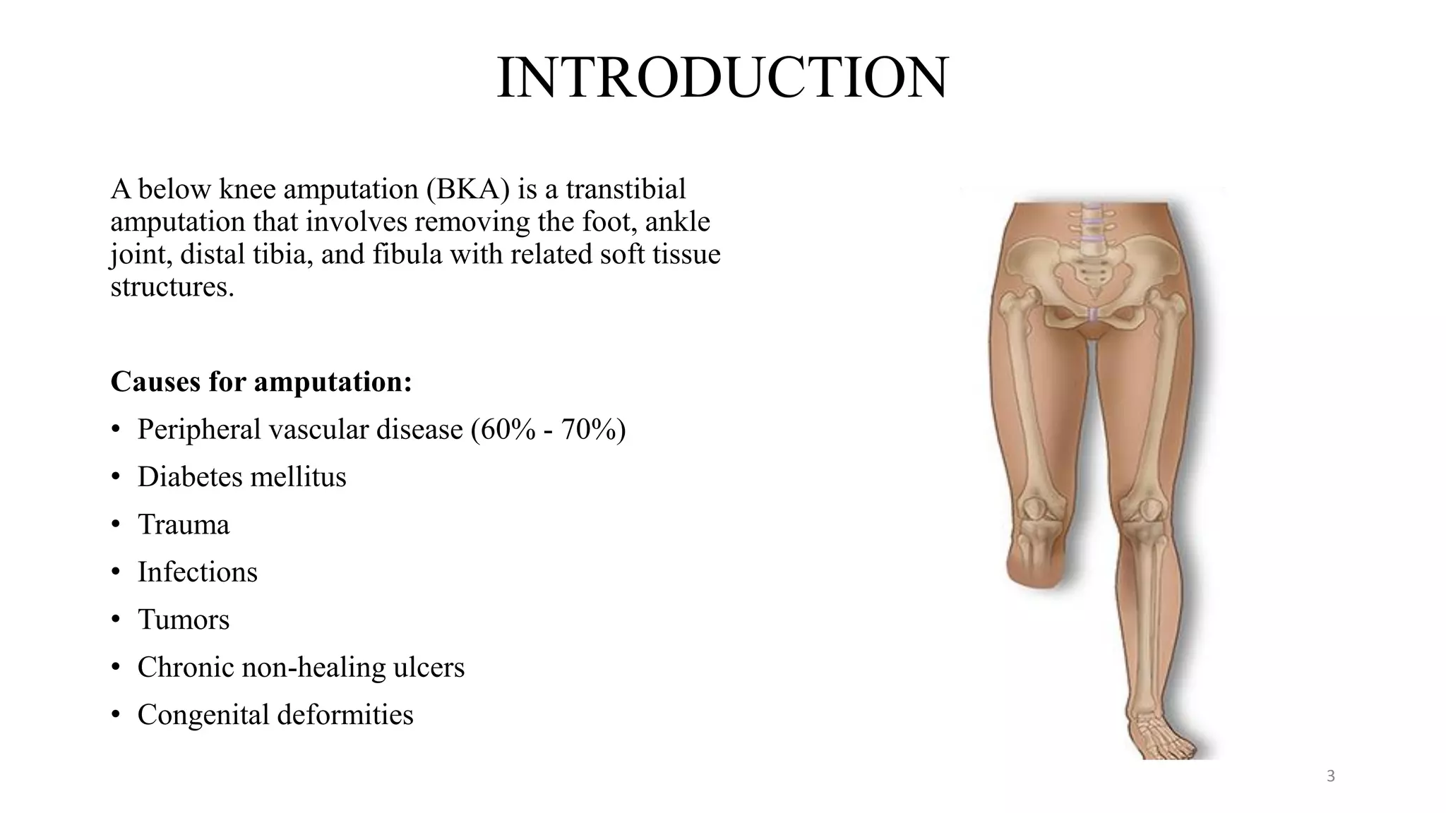PROSTHETIC MANAGEMENT OF TRANSTIBIAL AMPUTATION AND ITS BIOMECHANICS | PDF