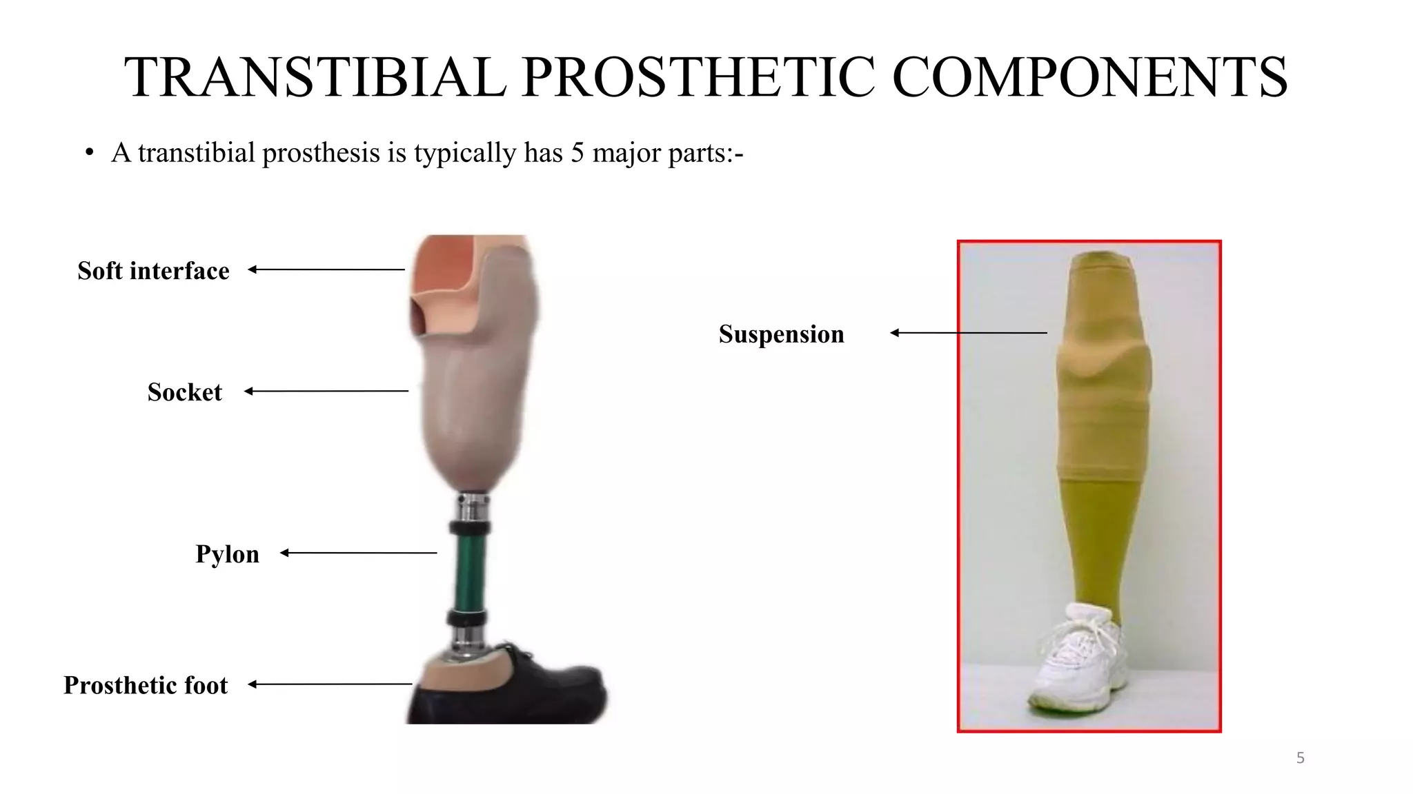 PROSTHETIC MANAGEMENT OF TRANSTIBIAL AMPUTATION AND ITS BIOMECHANICS | PDF