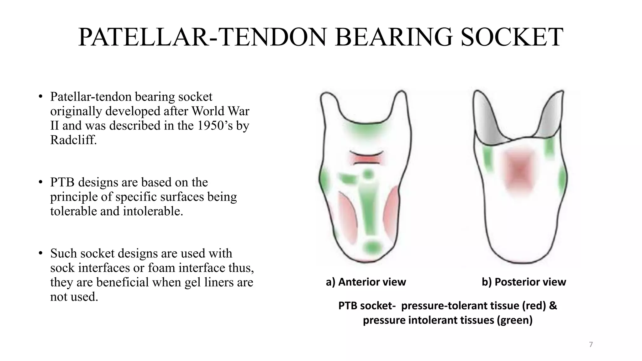PROSTHETIC MANAGEMENT OF TRANSTIBIAL AMPUTATION AND ITS BIOMECHANICS | PDF