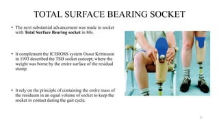 PROSTHETIC MANAGEMENT OF TRANSTIBIAL AMPUTATION AND ITS BIOMECHANICS | PDF