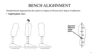 PROSTHETIC MANAGEMENT OF TRANSTIBIAL AMPUTATION AND ITS BIOMECHANICS | PDF
