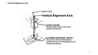 PROSTHETIC MANAGEMENT OF TRANSTIBIAL AMPUTATION AND ITS BIOMECHANICS | PDF