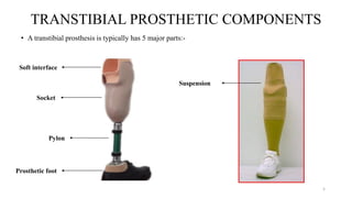 PROSTHETIC MANAGEMENT OF TRANSTIBIAL AMPUTATION AND ITS BIOMECHANICS | PDF