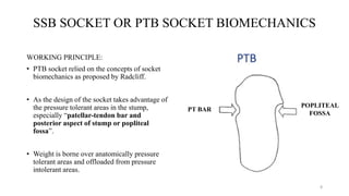 PROSTHETIC MANAGEMENT OF TRANSTIBIAL AMPUTATION AND ITS BIOMECHANICS | PDF