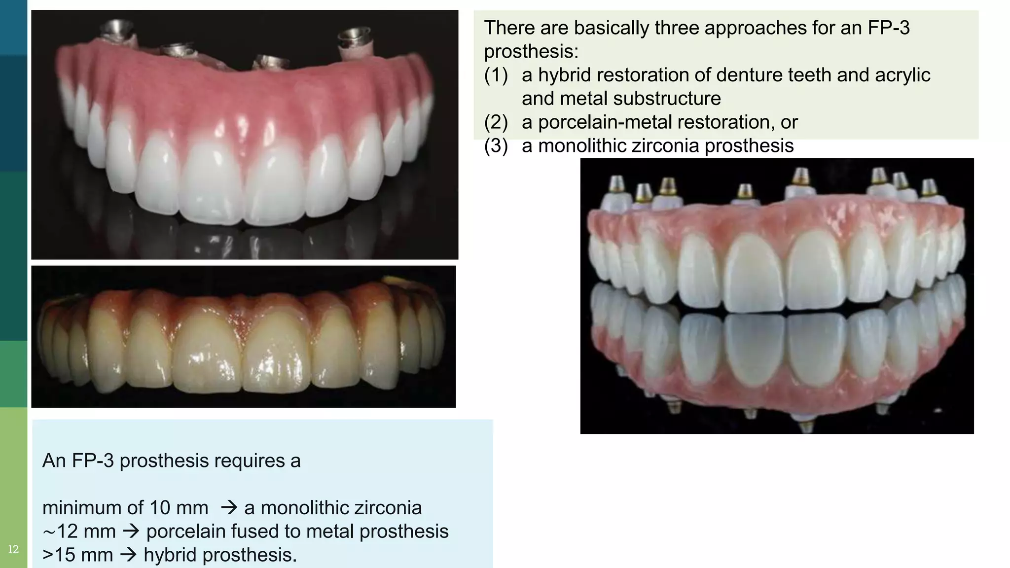 prosthetic options in implant | PPTX