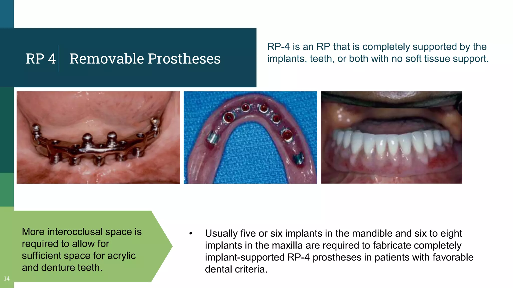 prosthetic options in implant | PPTX