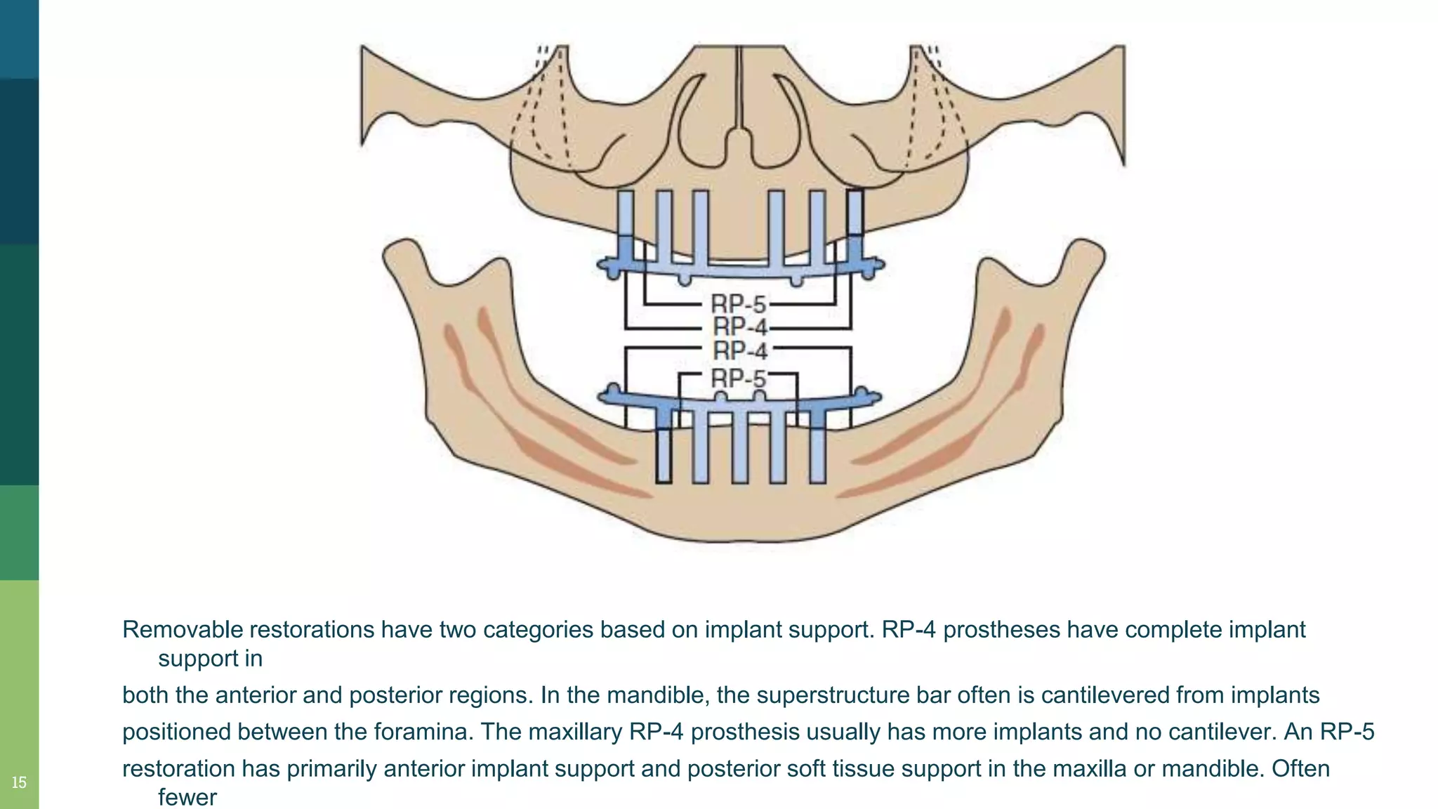 prosthetic options in implant | PPTX