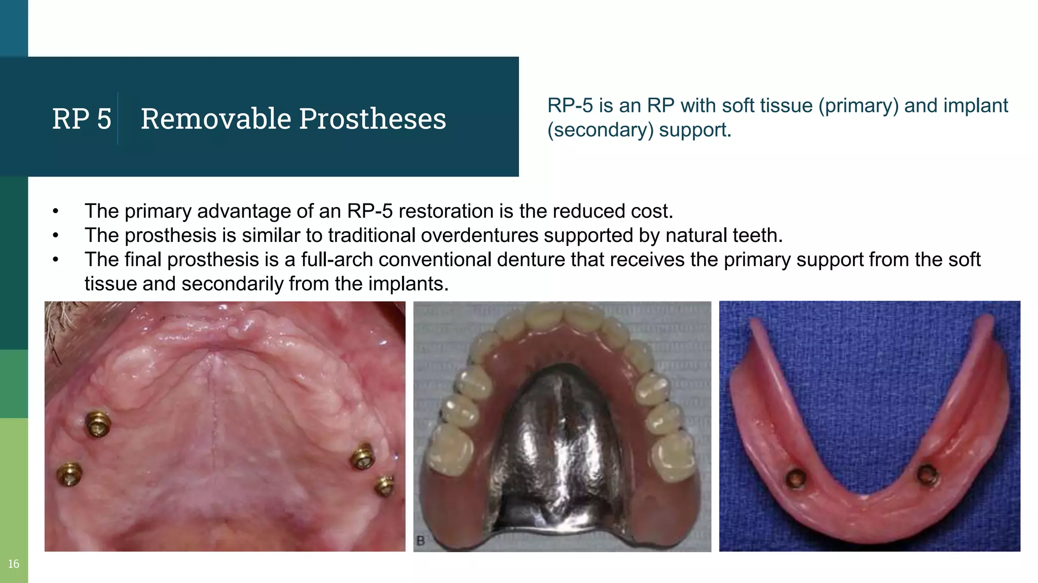 prosthetic options in implant | PPTX