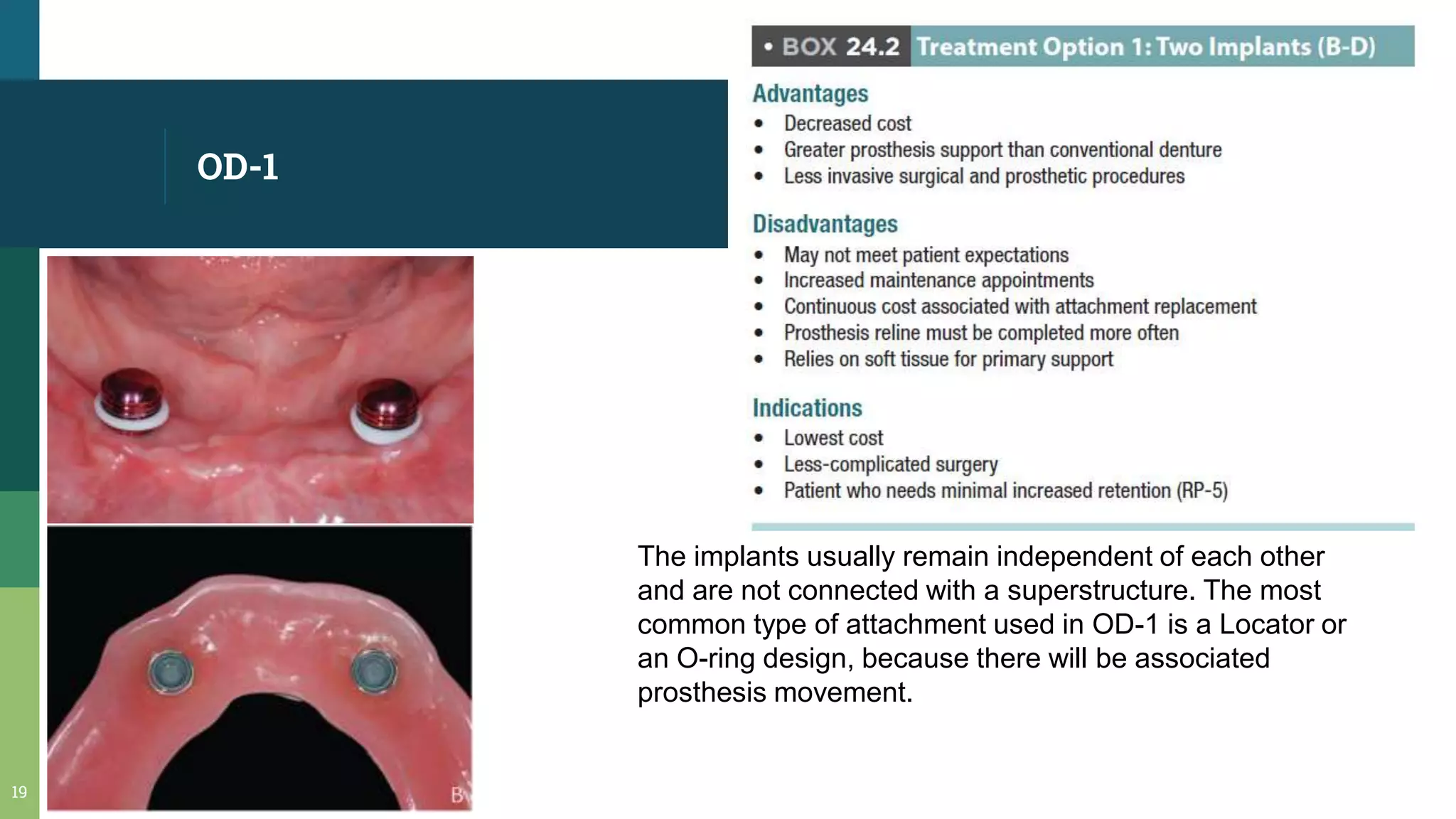 prosthetic options in implant | PPTX