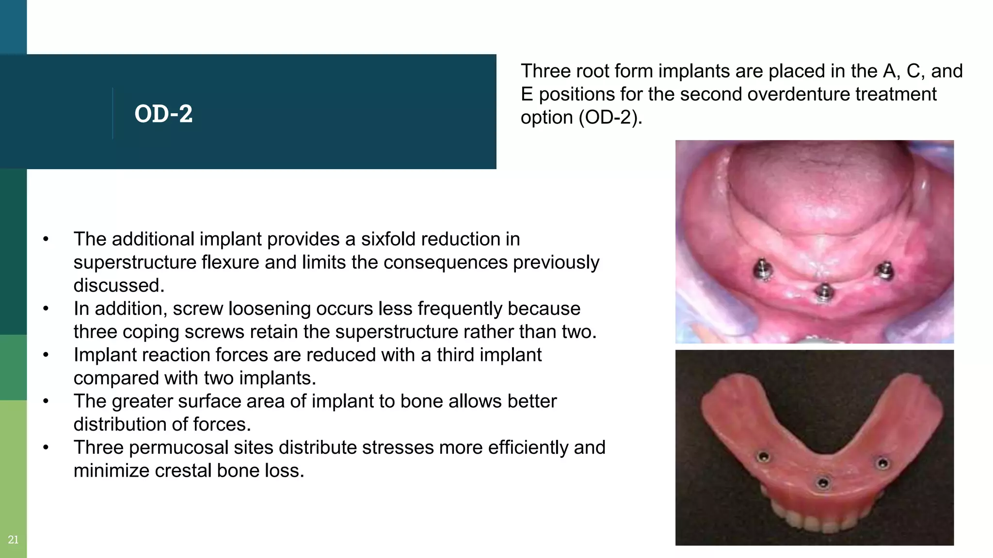 prosthetic options in implant | PPTX