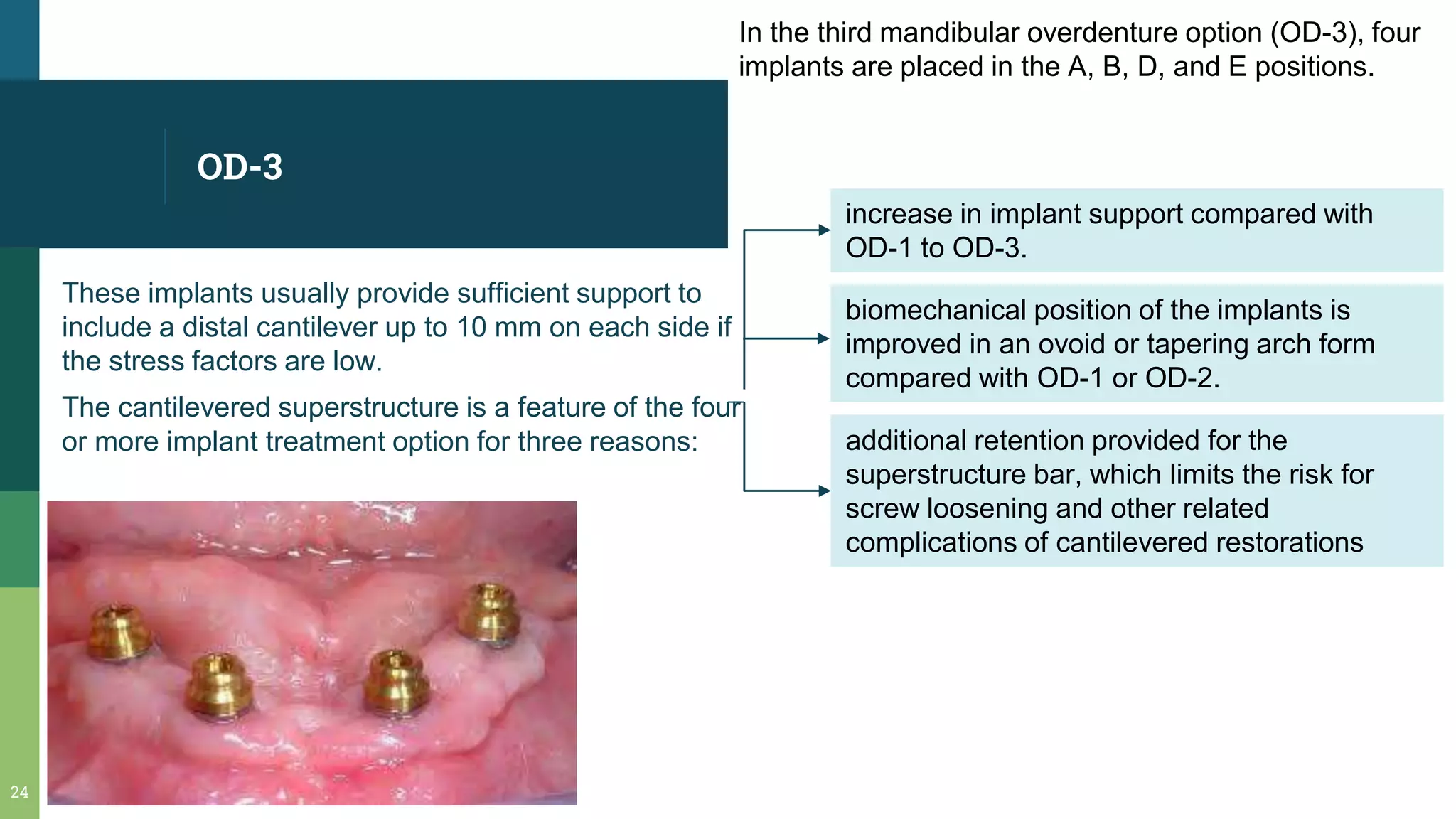 prosthetic options in implant | PPTX
