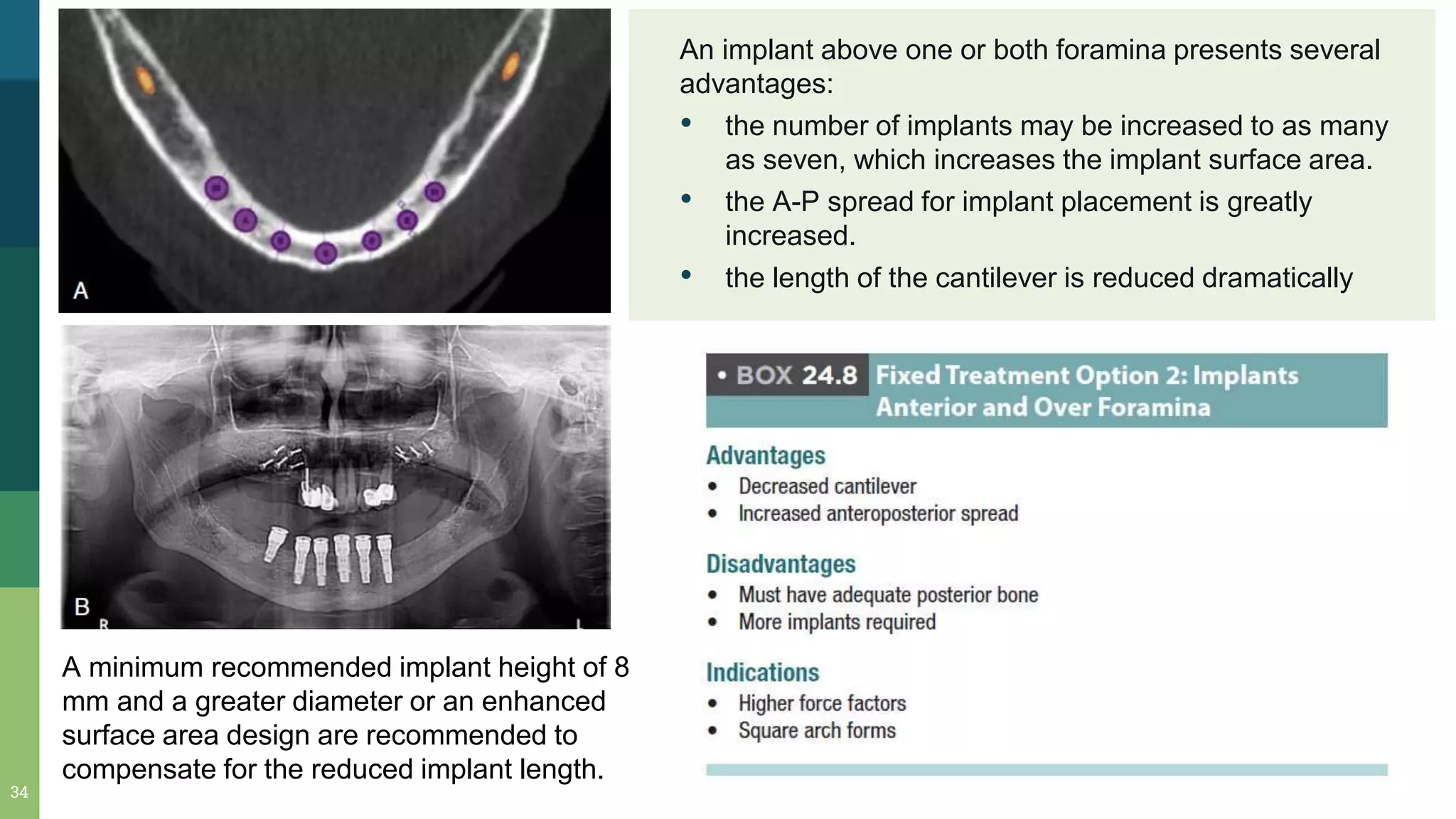 prosthetic options in implant | PPTX