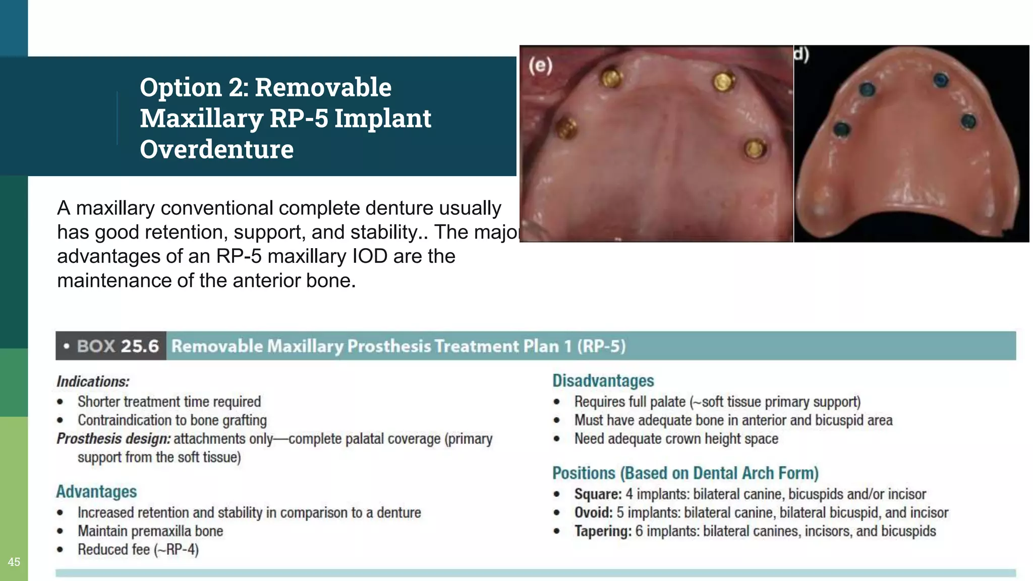 prosthetic options in implant | PPTX