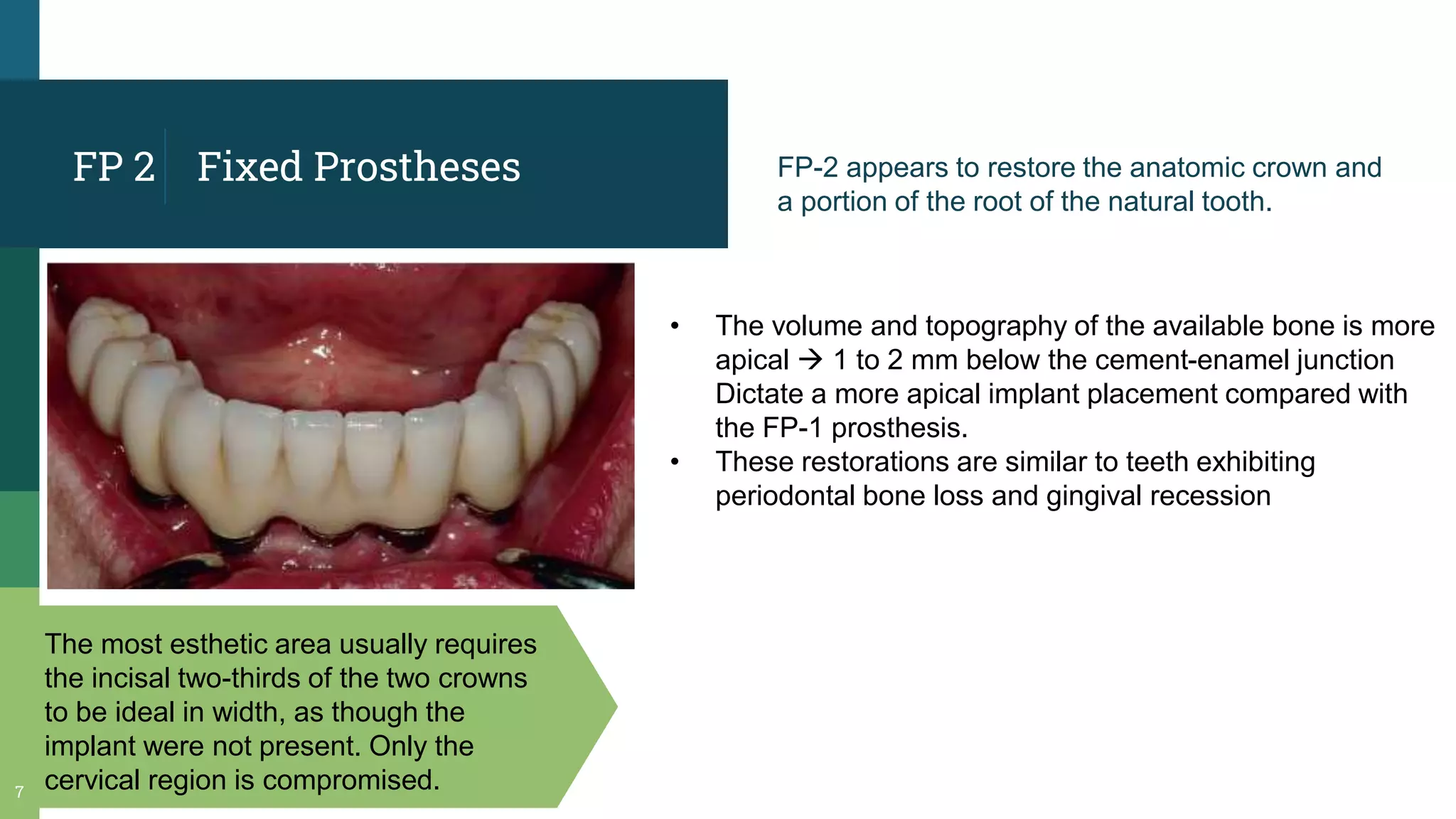 prosthetic options in implant | PPTX