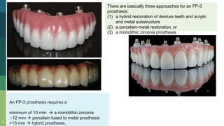 prosthetic options in implant | PPT