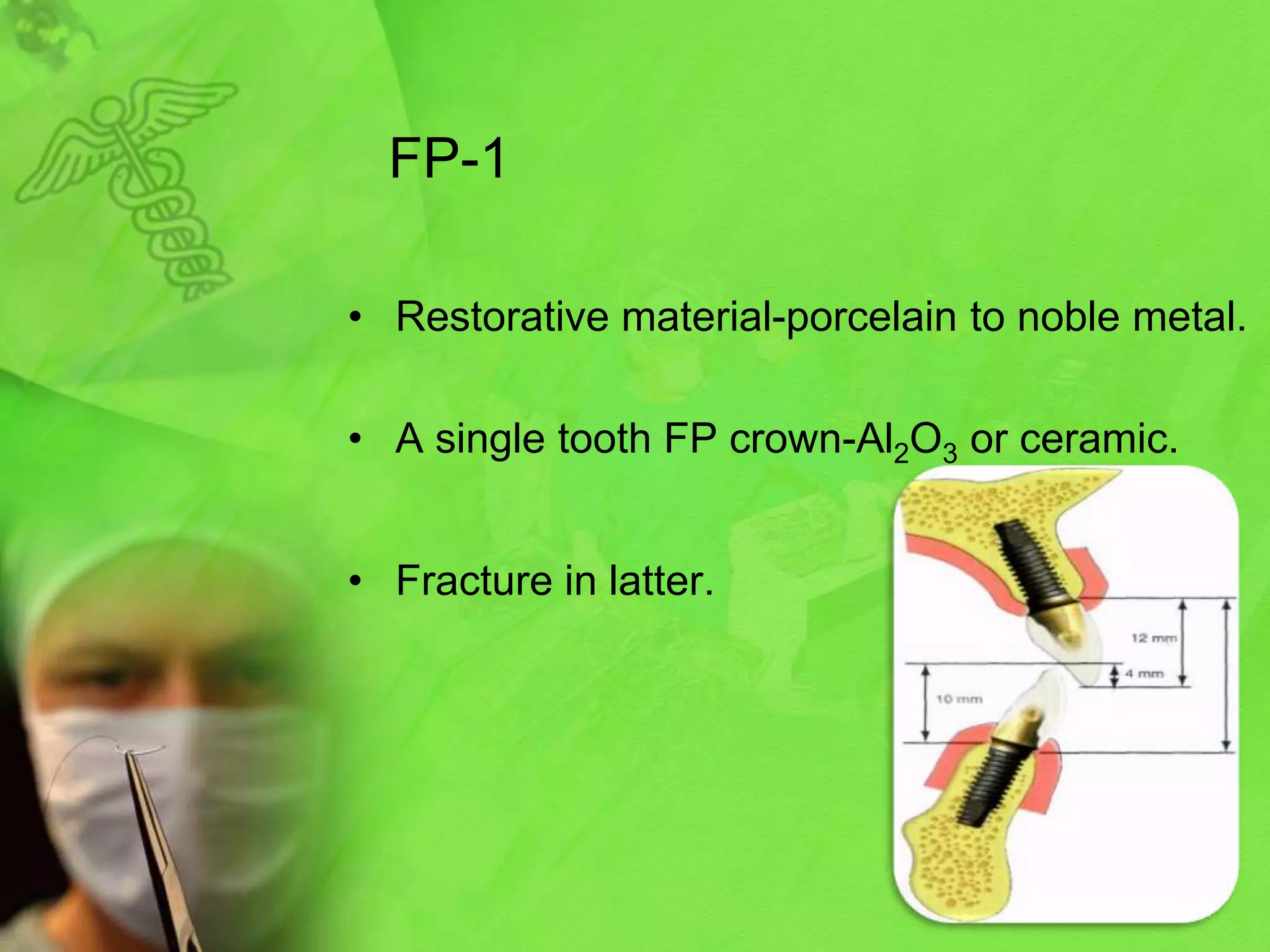 Prosthetic options in implant dentistry | PPTX