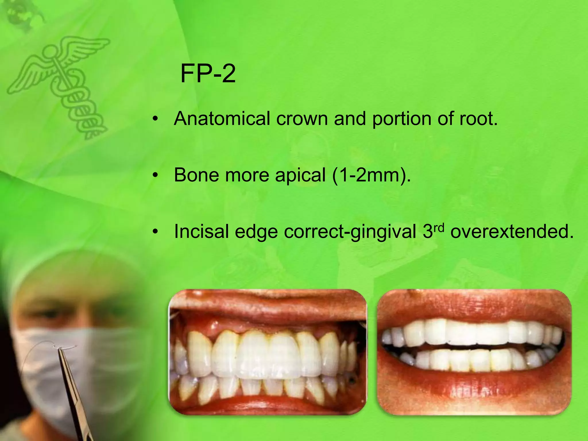 Prosthetic options in implant dentistry | PPTX