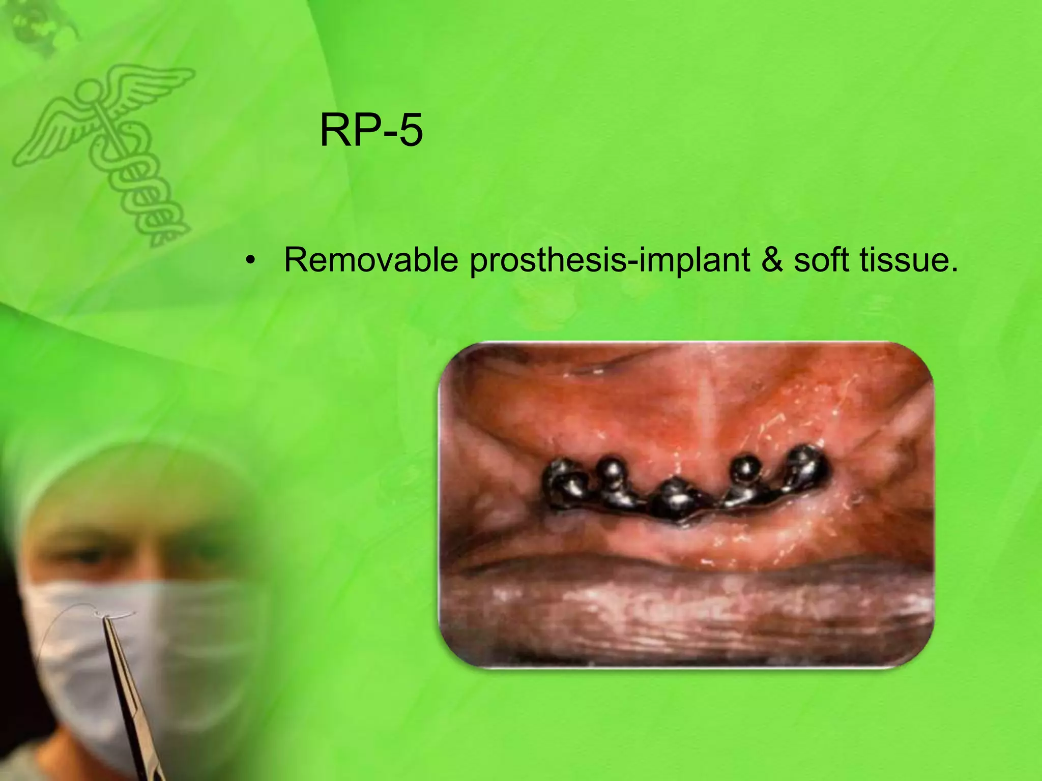 Prosthetic options in implant dentistry | PPTX
