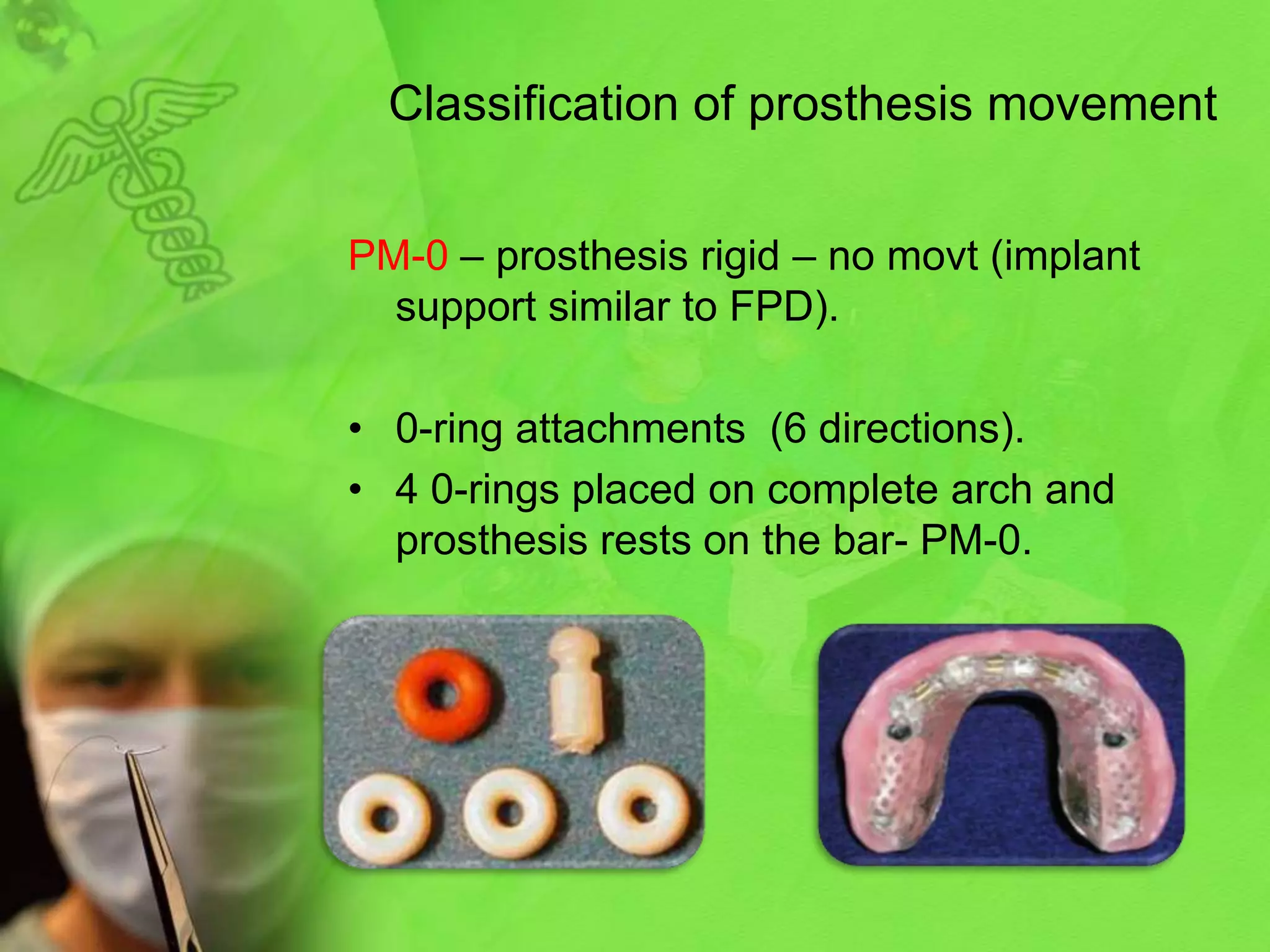 Prosthetic options in implant dentistry | PPTX