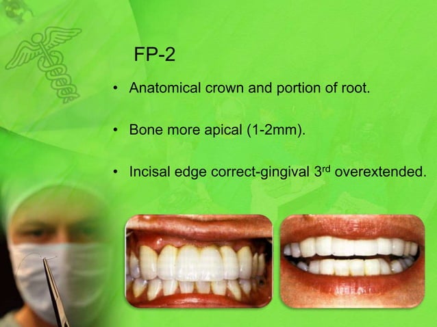 Prosthetic options in implant dentistry | PPTX | Dental Health ...