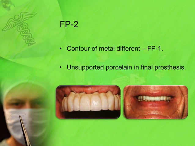 Prosthetic options in implant dentistry | PPTX | Dental Health ...