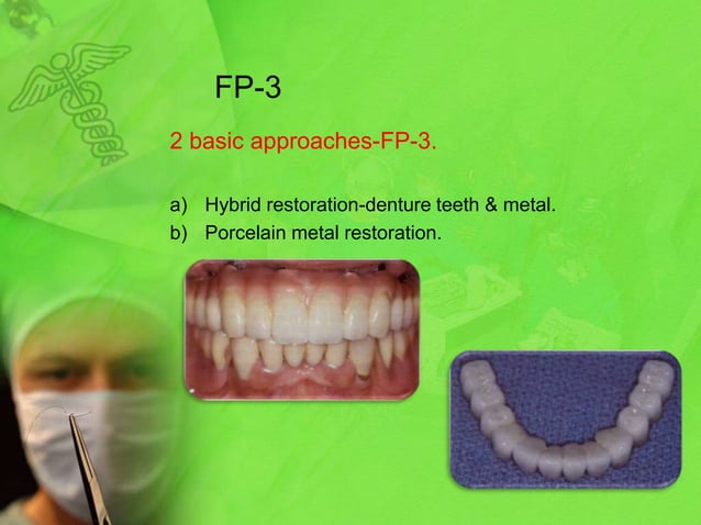 Prosthetic options in implant dentistry | PPTX | Dental Health ...