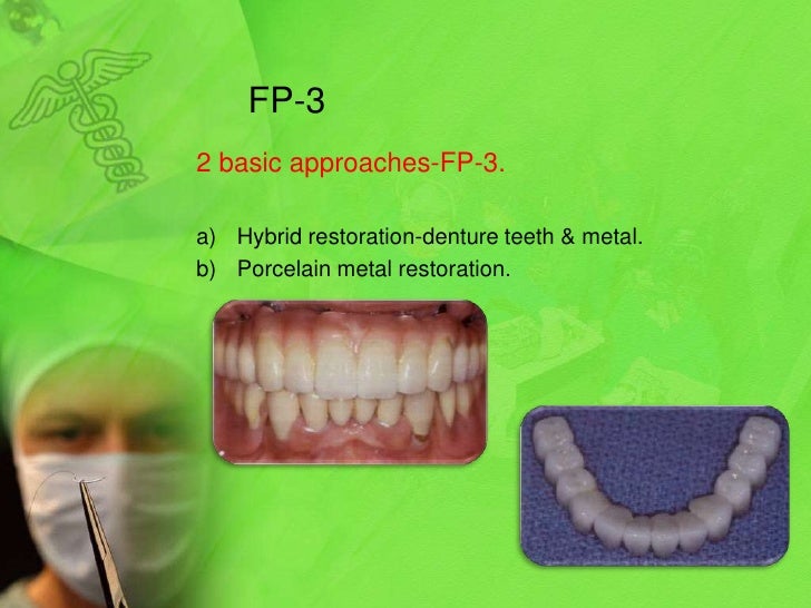Prosthetic options in implant dentistry