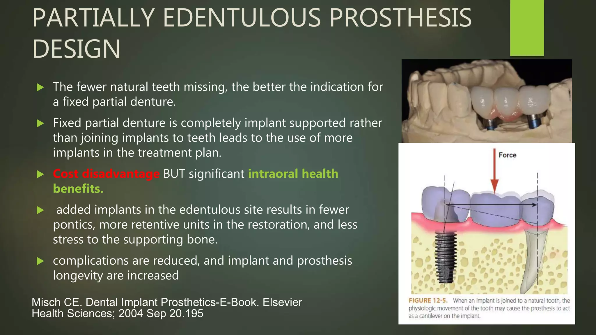 Prosthetic options in implant dentistry | PPTX
