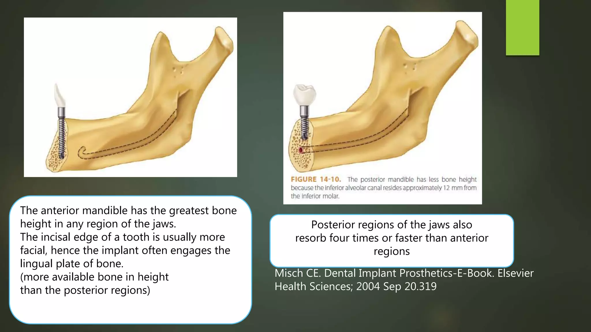 Prosthetic options in implant dentistry | PPTX